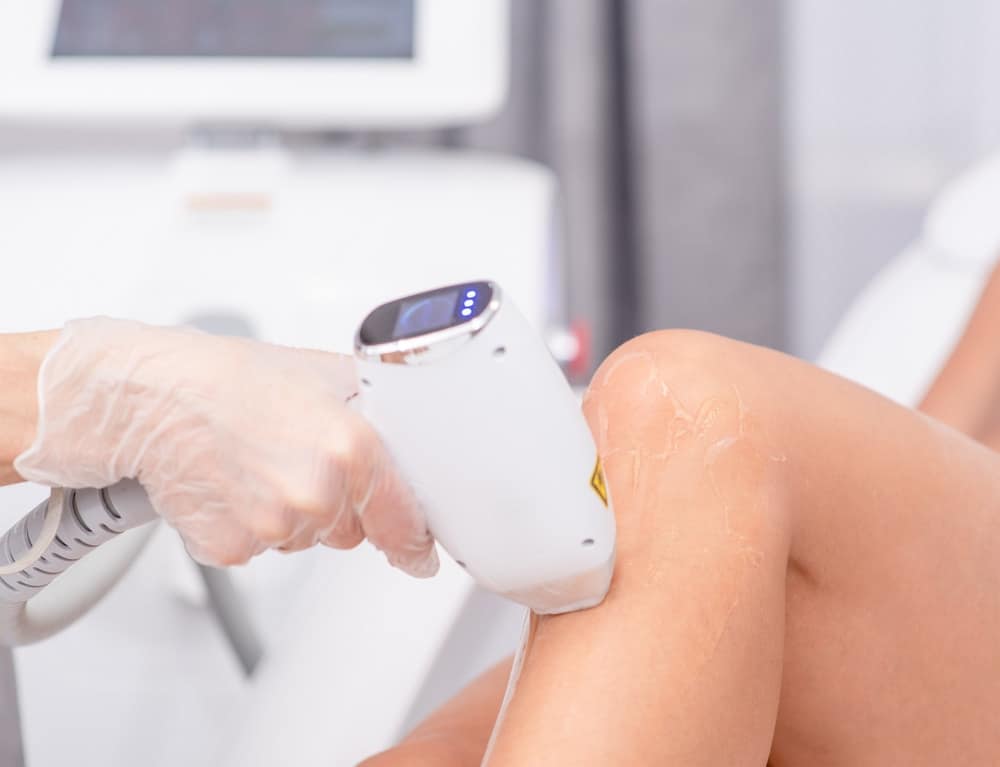 5 Tips for Managing Stubble After Laser Hair Removal