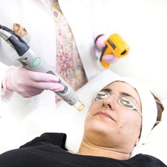 Rosacea Treatment | Progen Aesthetics