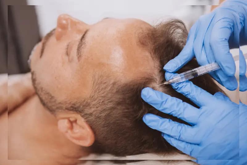 Best PRP Treatments in the UK: A Comprehensive Guide