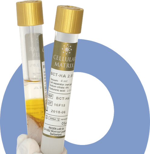 PRP Facial (Vampire Facial) | Progen Aesthetics