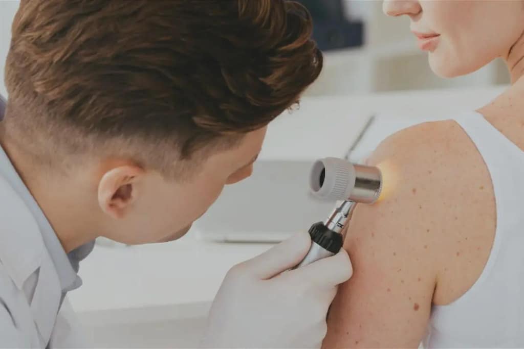 The Different Types of Moles You Should Know About